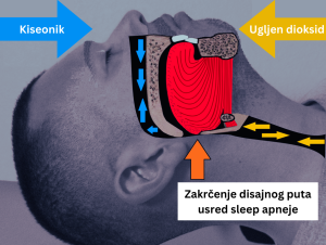 Monitoring spavačke apneje (sleep apnea), Beograd, Cena 4.000 din